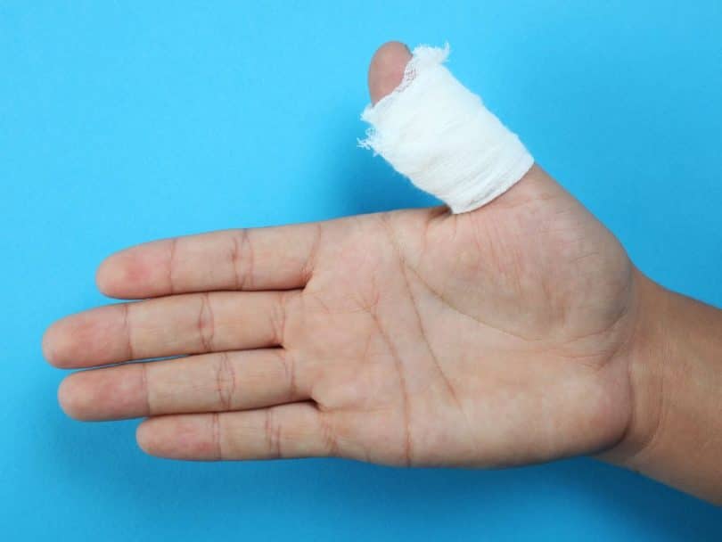 Panaris - Quand faut-il consulter pour une infection au doigt ou à l ...